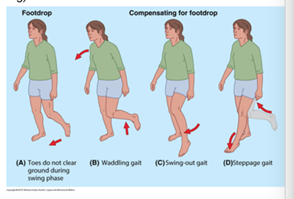 Muscle strength testing – The most important test for lumbar ...