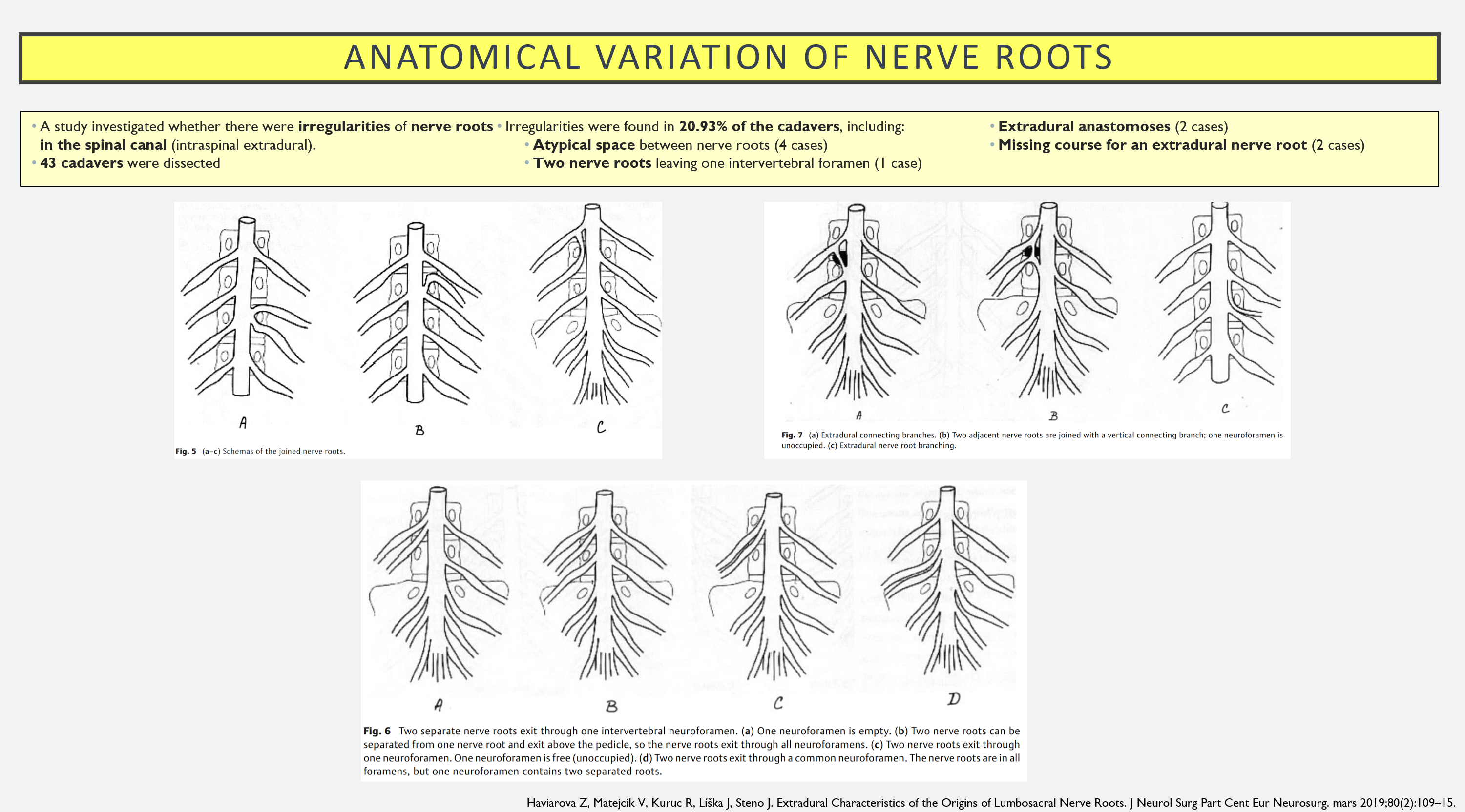 What is a herniated disc? – The Scandi Physio – Simen Sletten