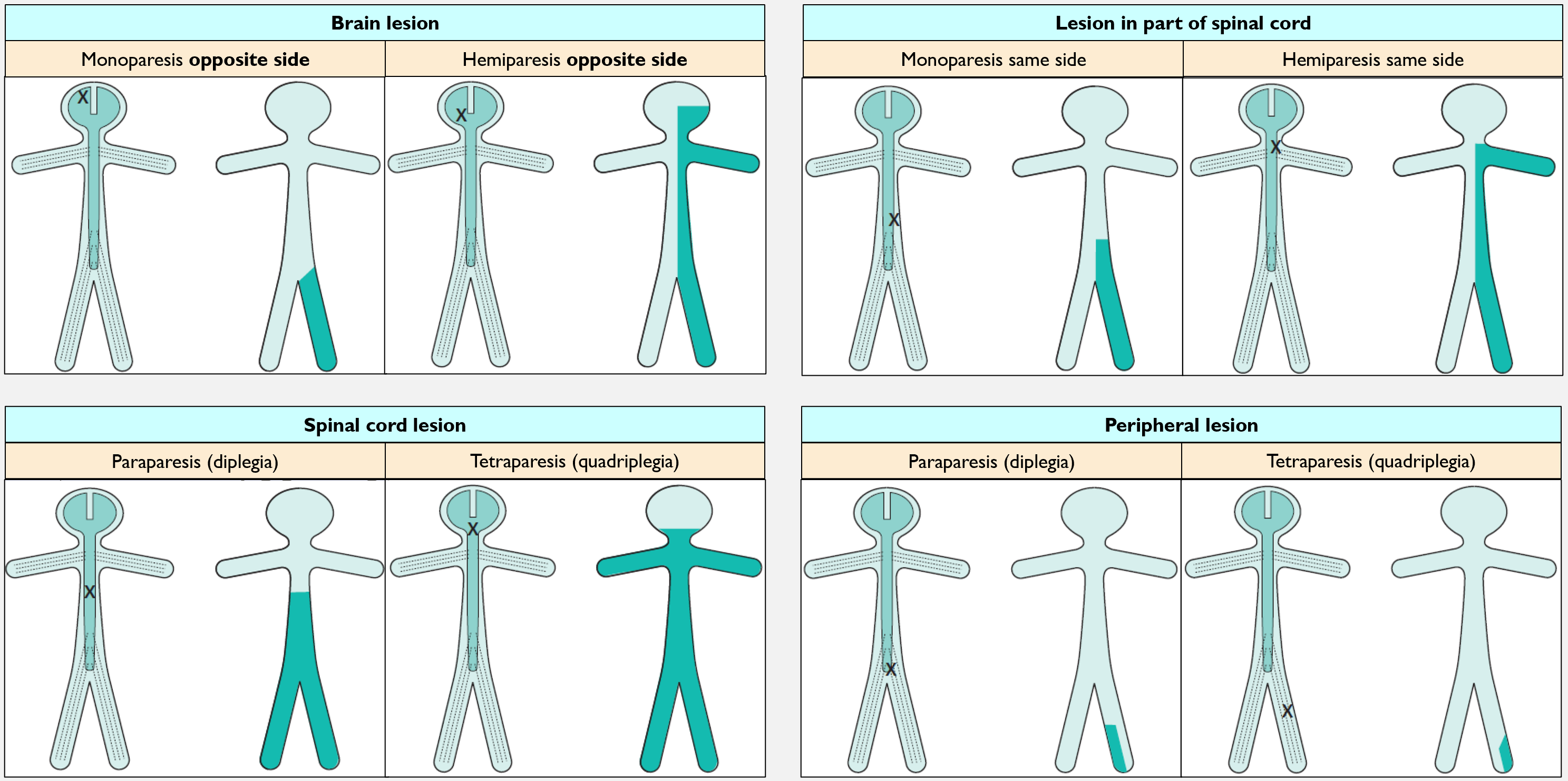 How to Tell Apart Central and Peripheral Nervous System Injuries – The ...