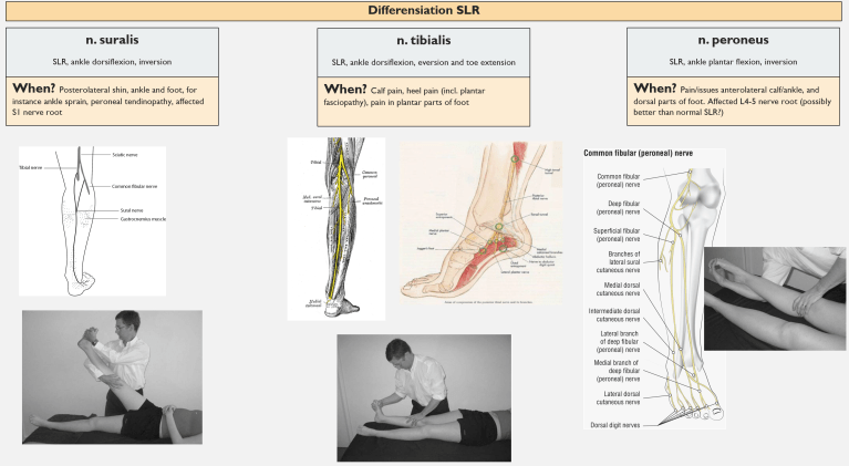 Neurodynamic tests – part 2: Lasegue, slump, n. femoralis – The Scandi ...