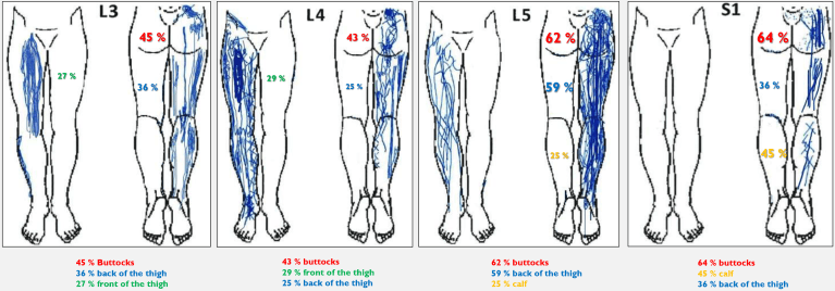 Sensory exam, part 3: Which dermatome map is the best? – The Scandi ...