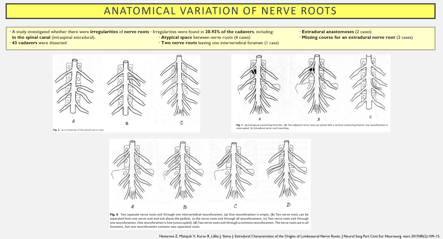 Sensory exam, part 3: Which dermatome map is the best? – The Scandi ...